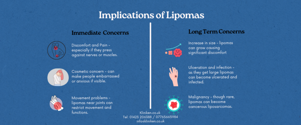 Stop Ignoring That Lump! Here’s Why Quick Action on Lipomas is Key ...
